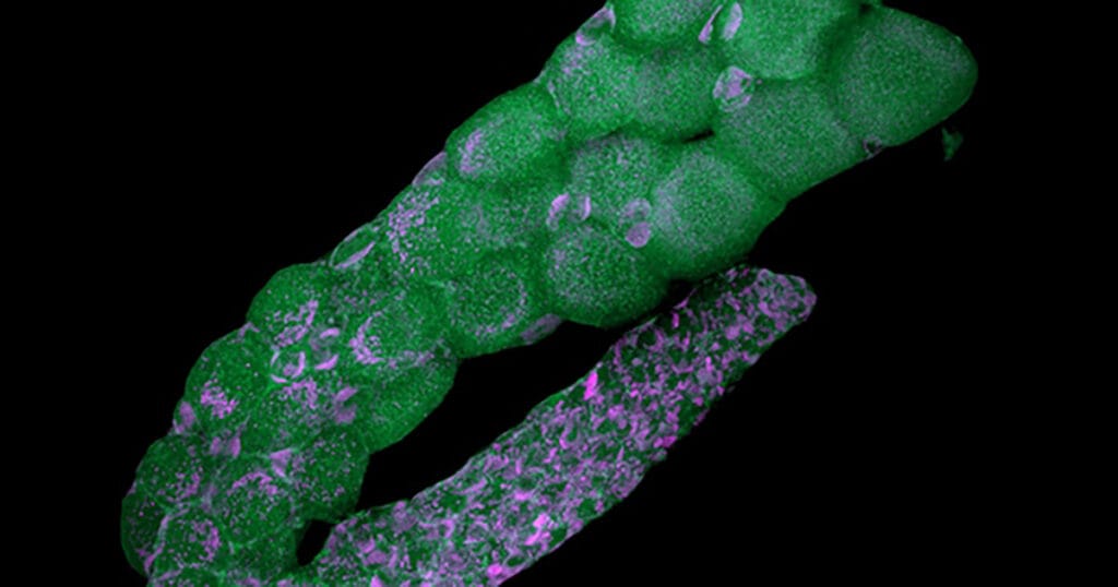 Imaging Reveals Bacterial Symbionts in the Ovaries of Tiny, Aquatic ...